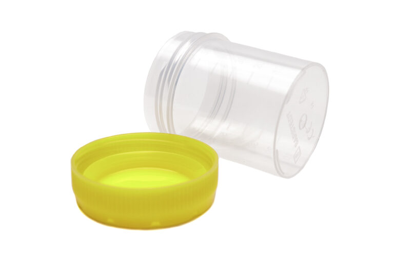 Plastic Specimen Tubes/Vials with screw caps (Reagent and centrifuge ...