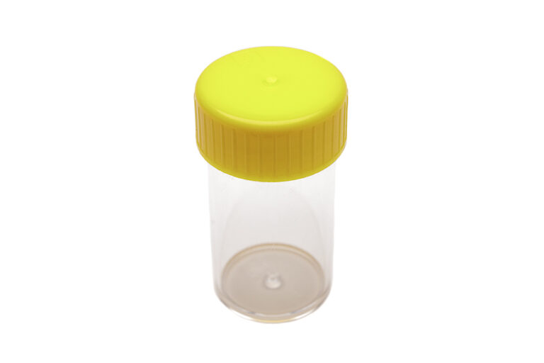 Plastic Specimen Tubes/Vials with screw caps (Reagent and centrifuge ...